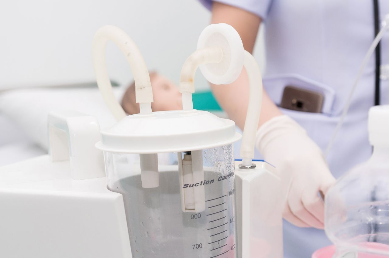 สายดูดเสมหะ สายSuction สำคัญอย่างไร พร้อมแนะนำอุปกรณ์ดูดเสมหะแบบใช้ได้ ...
